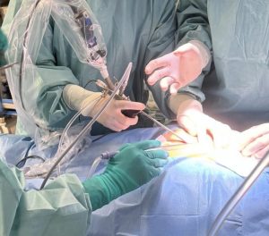 Cisti Pilonidale: Cause, Sintomi e Trattamenti | Dr. Giacomo Sarzo